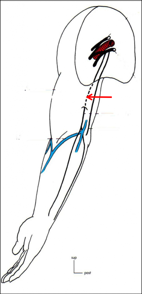 Cours Anatomie Nerf ulnaire nerf cutané médial- l’avant bras